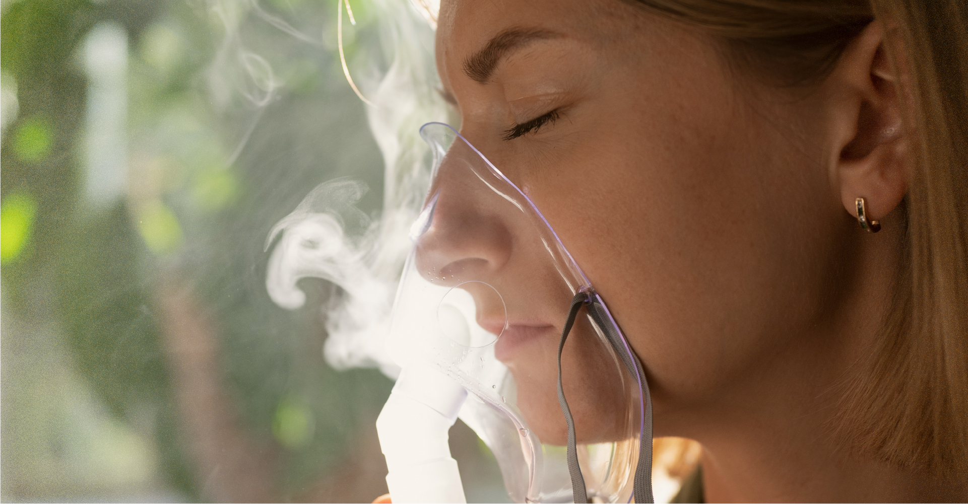 arbogen CO2 treatment – 5 sessions | Oxygeno